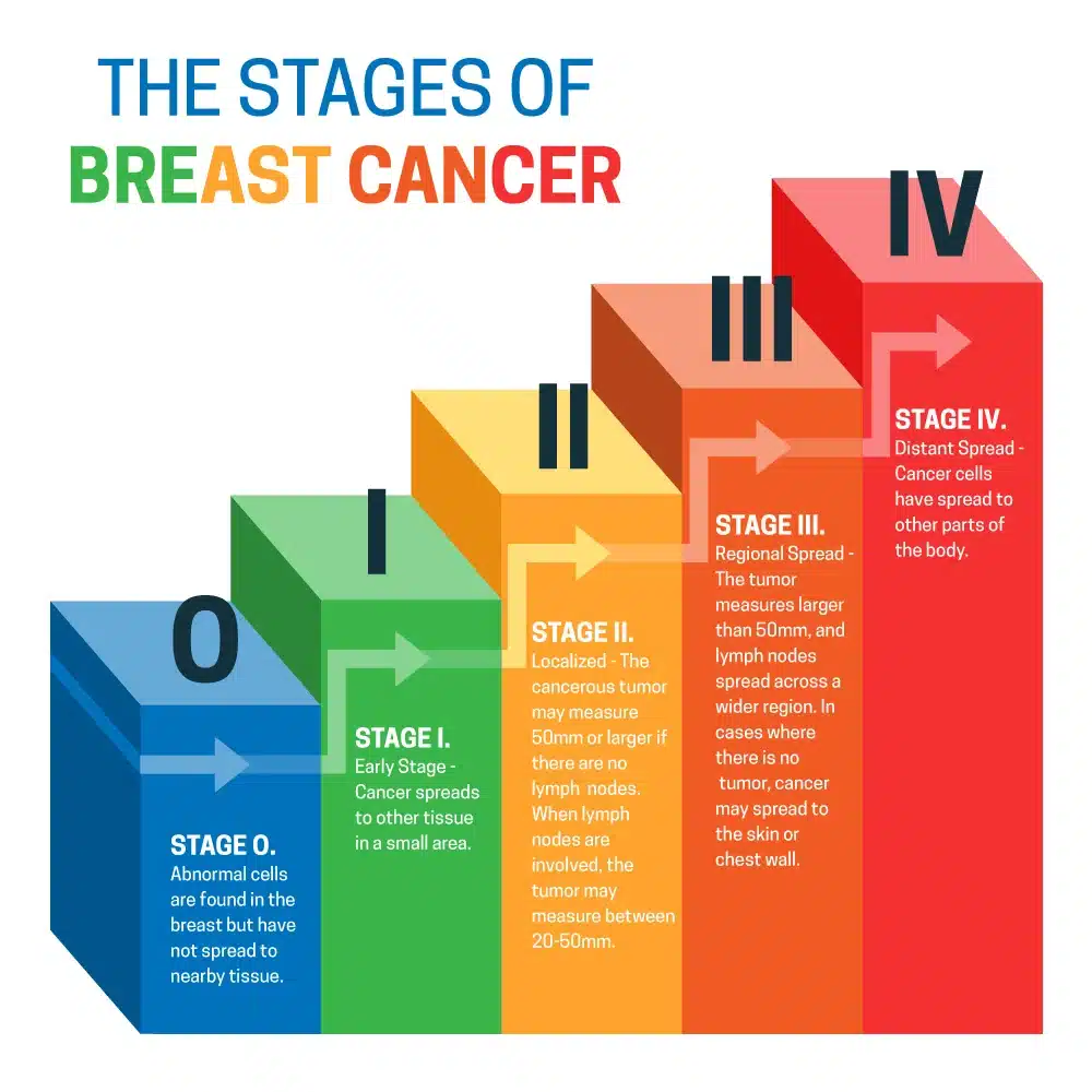 Breast Cancer Stages: Understanding the Journey - Pinkribbon